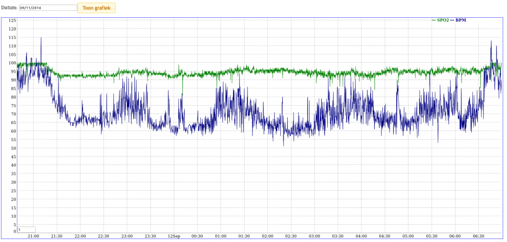 Cardio and oxygen saturation monitoring at home - Jeroen Baten