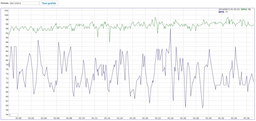 Cardio and oxygen saturation monitoring at home - Jeroen Baten